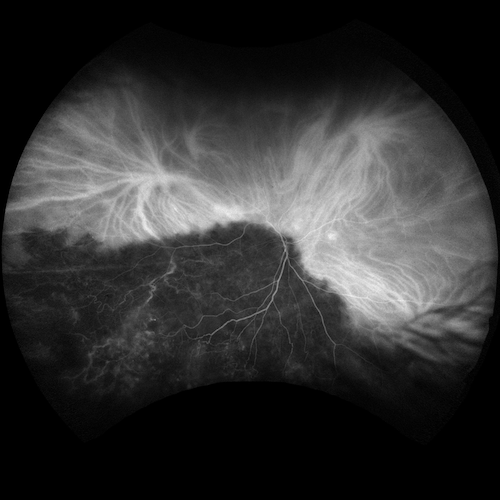 Duke Ophthalmic Photographers Earn Top Awards | Duke Department Of ...